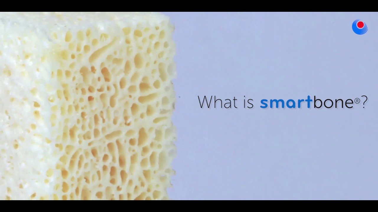 What is Smartbone? - YouTube