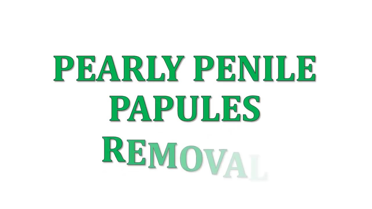 How to remove Pearly Penile Papules at home fast and easy - YouTube