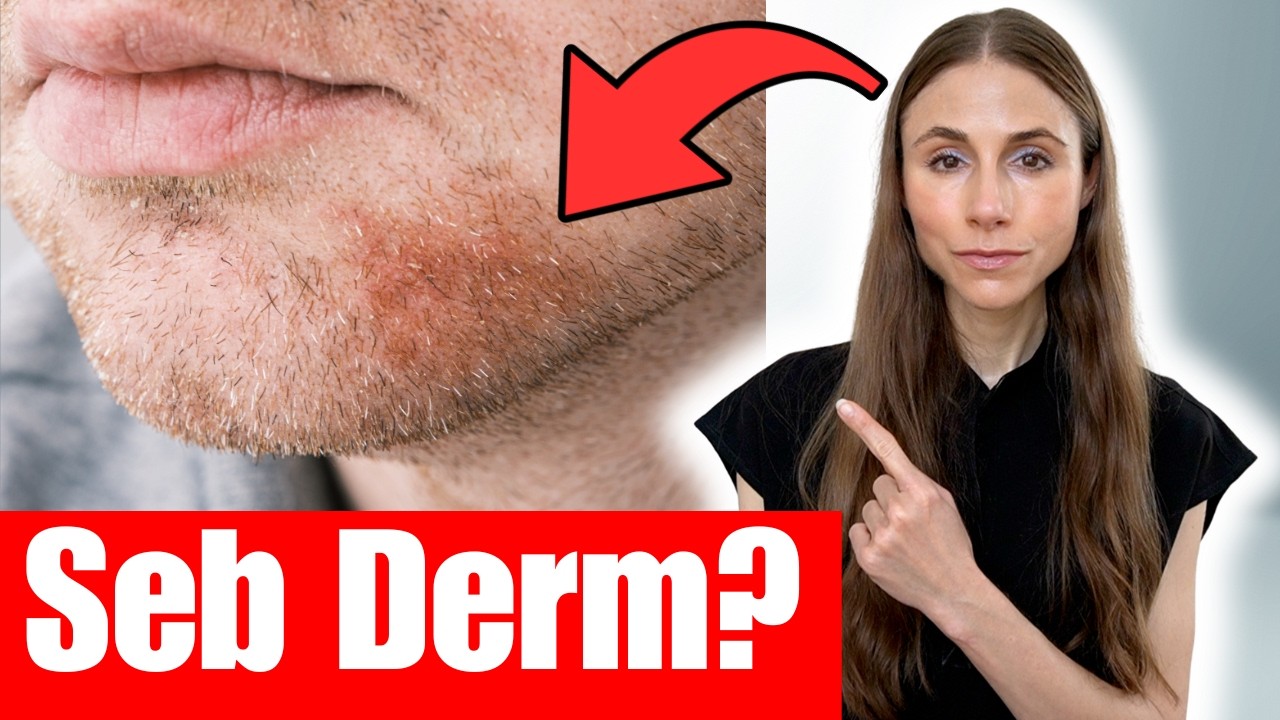 Dermatologist Explains How To Treat Seborrheic Dermatitis (Dandruff ...