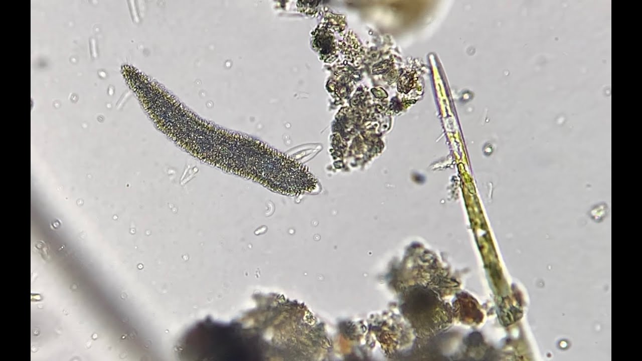 Hawaii Kentrophoros Encounters Diatom Colony - YouTube