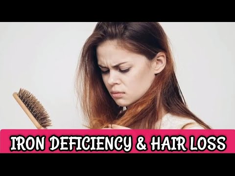 Iron Deficiency & Hair Loss: Essential Facts You Shouldn't Ignore ...