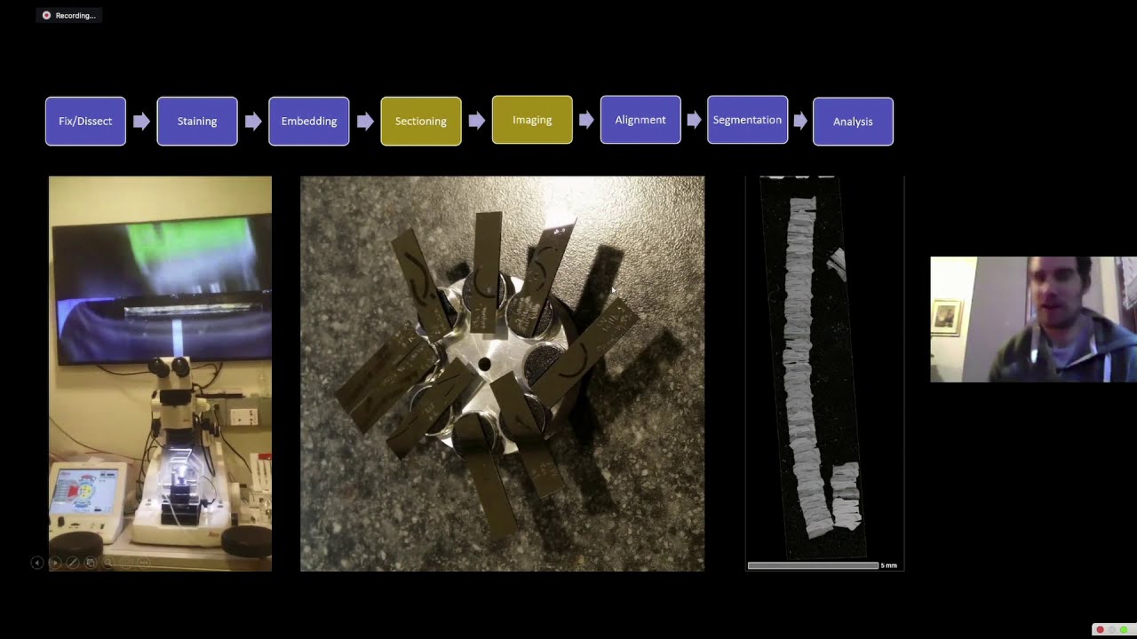 From Tissues to Nanoscopic Models & Insights: 3D Electron Microscopy ...