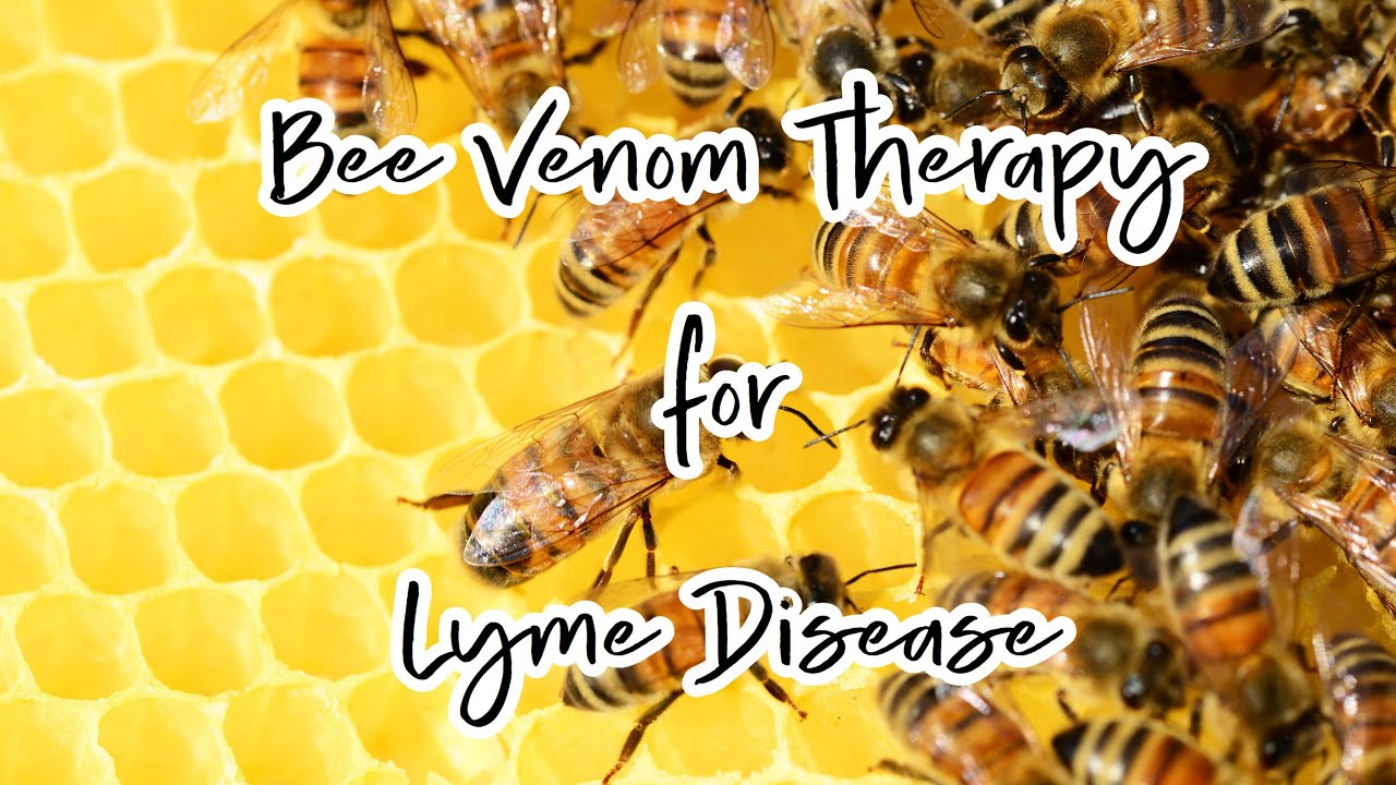 How to Start Bee Venom Therapy (BVT) / Lyme disease - YouTube