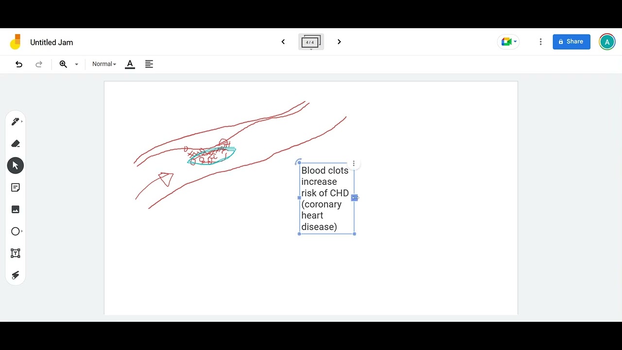 SNAB 1 6 blood clotting - YouTube