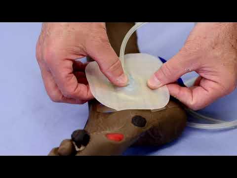 3M™ Snap™ Therapy System Detailed Application - YouTube