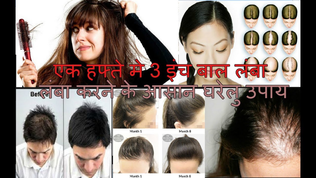 Hair Growth Tips एक हफ्ते मे 3 इंच बाल लंबा करने के आसान घरेलु उपाय