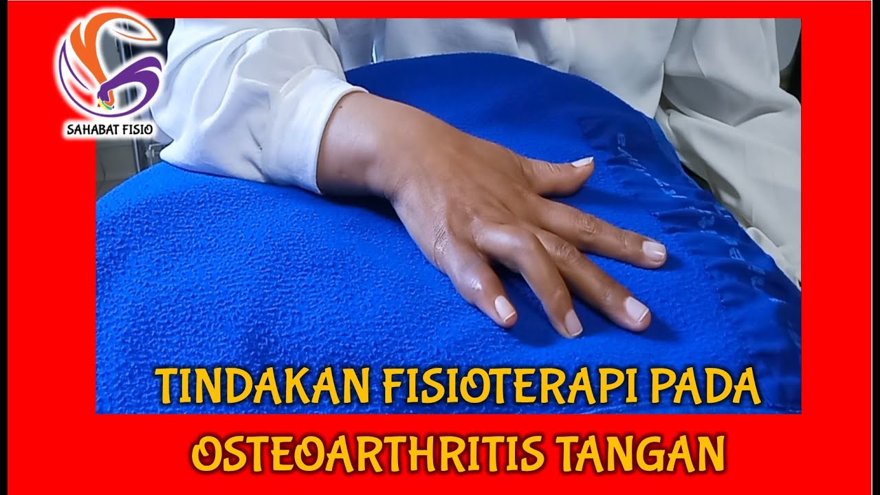 CARA FISIOTERAPI PADA OSTEOARTHRITIS JARI TANGAN - YouTube