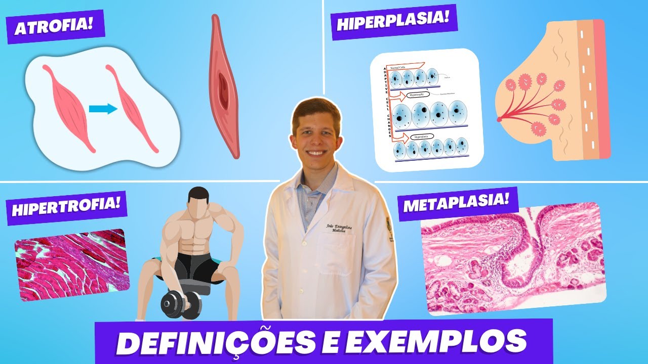 Adaptações Celulares: Atrofia, Hipertrofia, Hiperplasia e Metaplasia ...