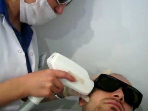 Lazer Epilasyon Seansı