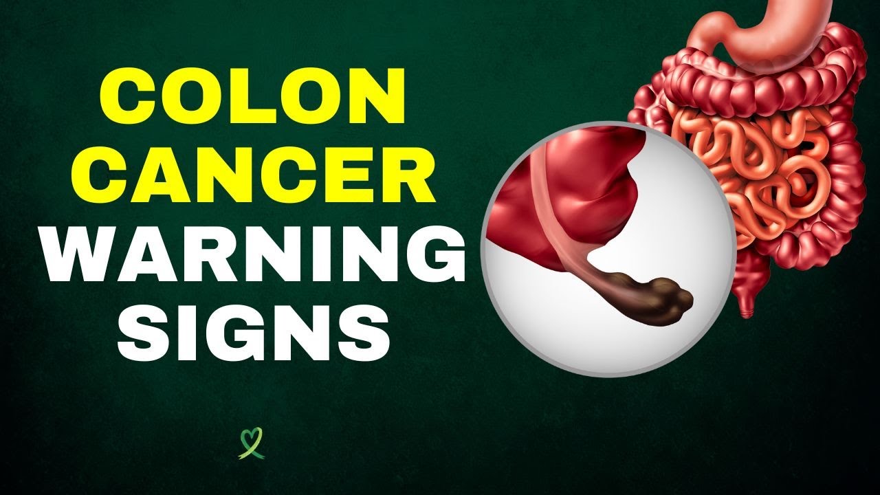 8 Warning Signs of Colon Cancer You Should Never Ignore - YouTube