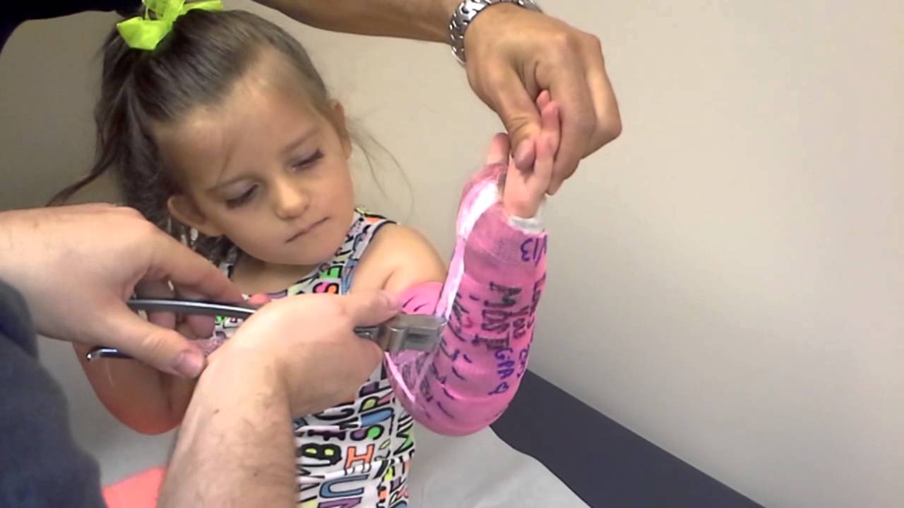 Taking Her Cast Off - YouTube