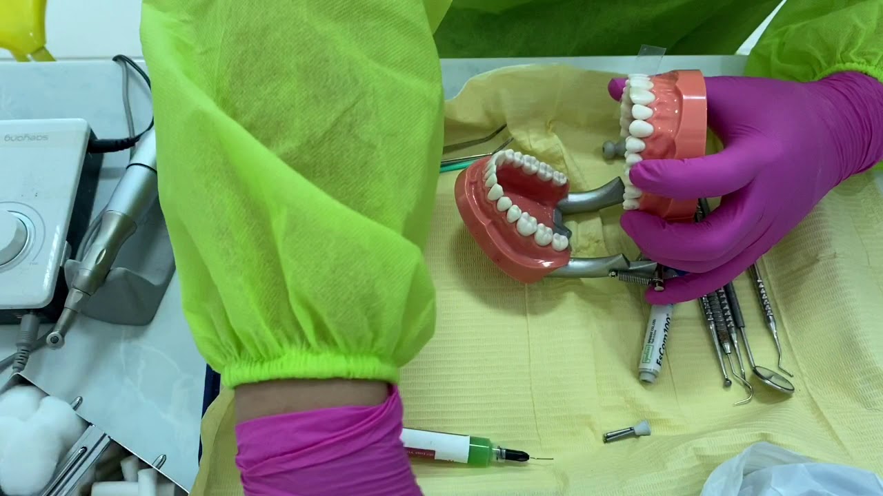 KIM Class IV Tooth Restoration 21 - YouTube