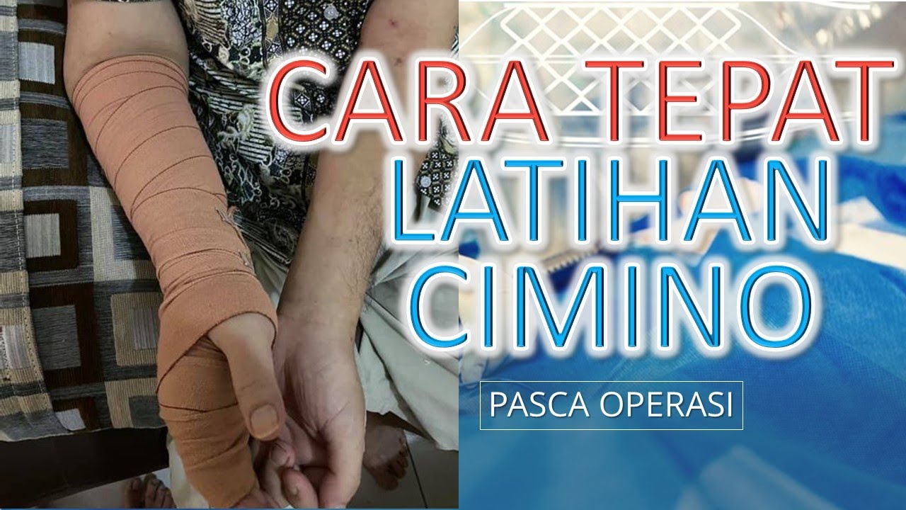 Cara Tepat Latihan Cimino / Av Shunt Pasca Operasi Akses Cuci Darah ...