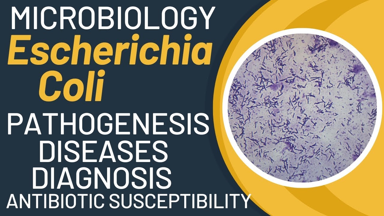 Escherichia coli pathogenesis | E. coli microbiology | e. coli general ...
