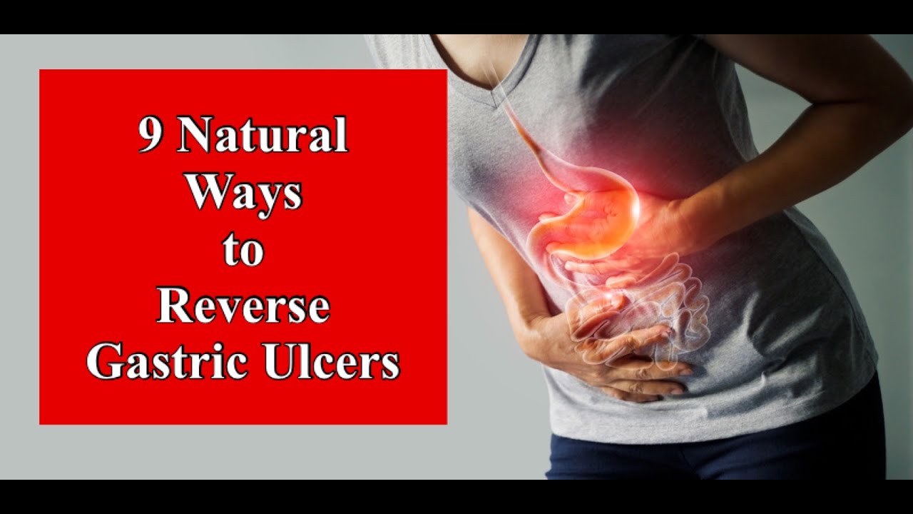 9 Natural Ways to Reverse Gastric Ulcers - YouTube