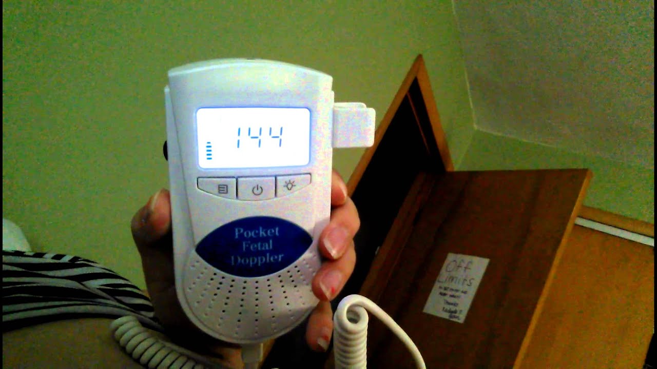 16 week HB With Sonoline B Fetal Doppler - YouTube
