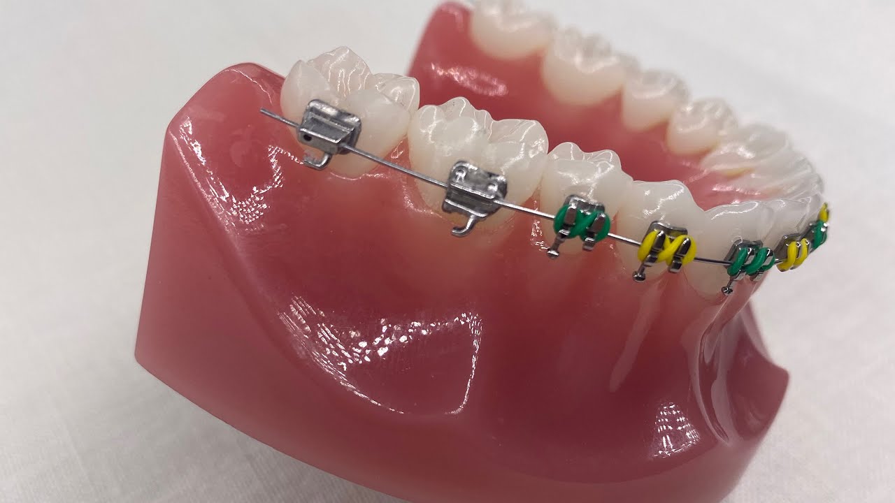 POKING WIRE At Home Solutions - YouTube