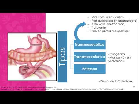 03 Hernias internas
