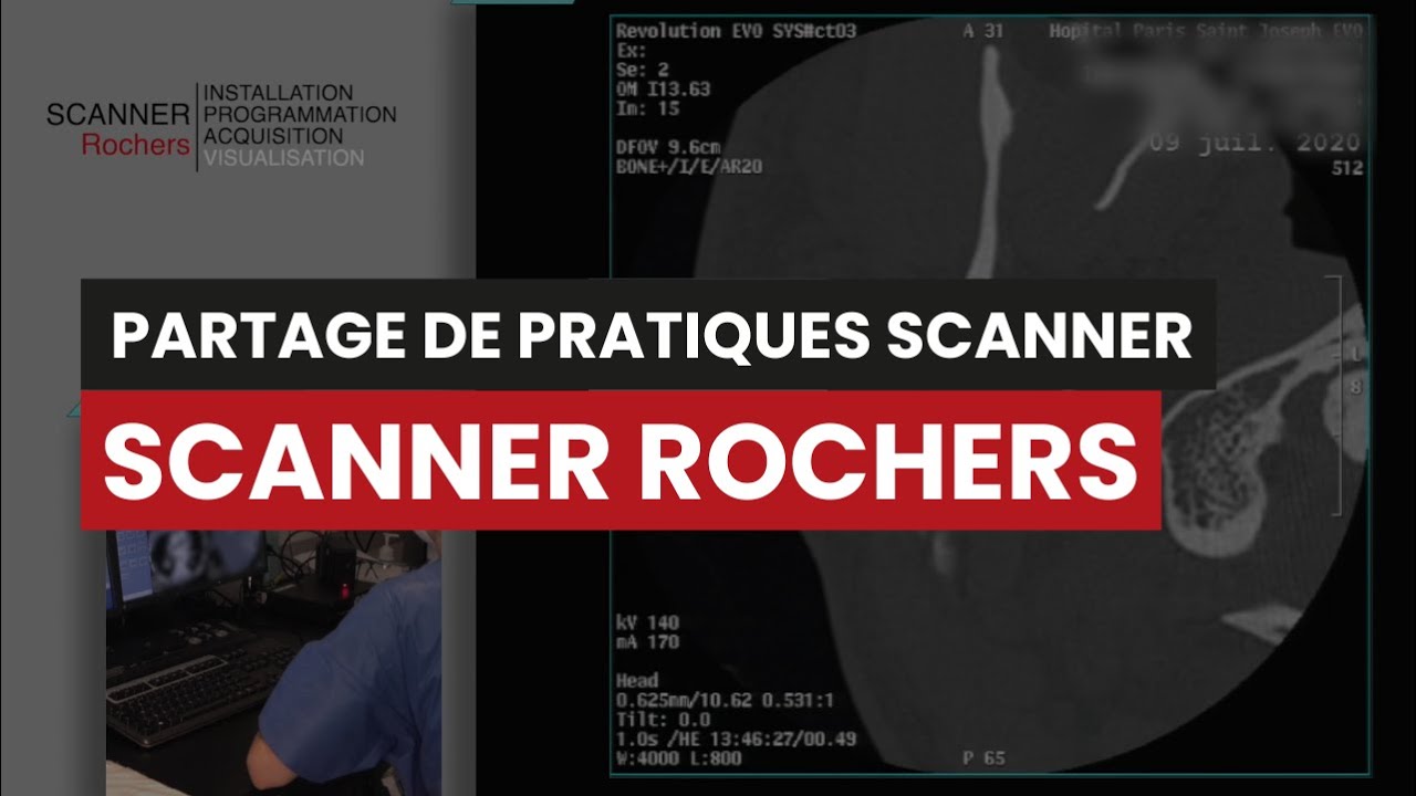CT SCANNER ROCHERS - Partage de pratique - YouTube
