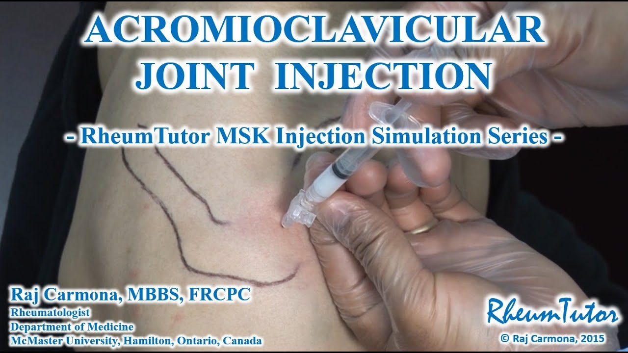 ACROMIOCLAVICULAR JOINT INJECTION: Step-By-Step Instructions - YouTube