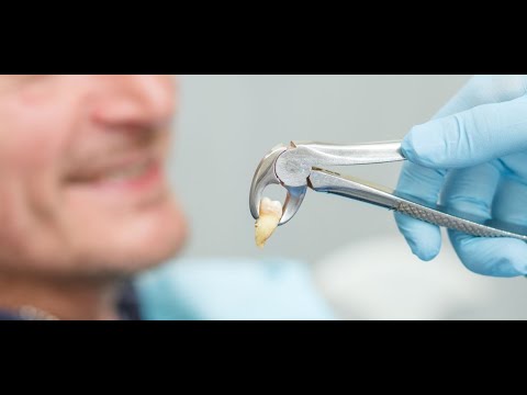 Wisdom tooth removal - How it's performed. Dental Surgery Los Angeles ...
