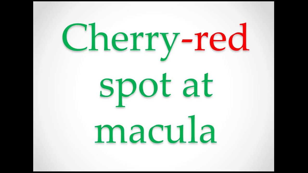 MRCPCH: Cherry-red spot at macula by MrcpchTeam - YouTube