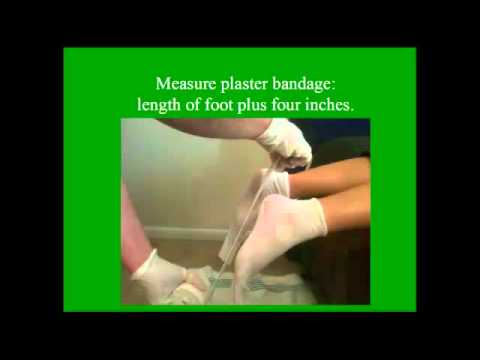 Casting A Foot in 3 Minutes - custom foot orthotics - YouTube