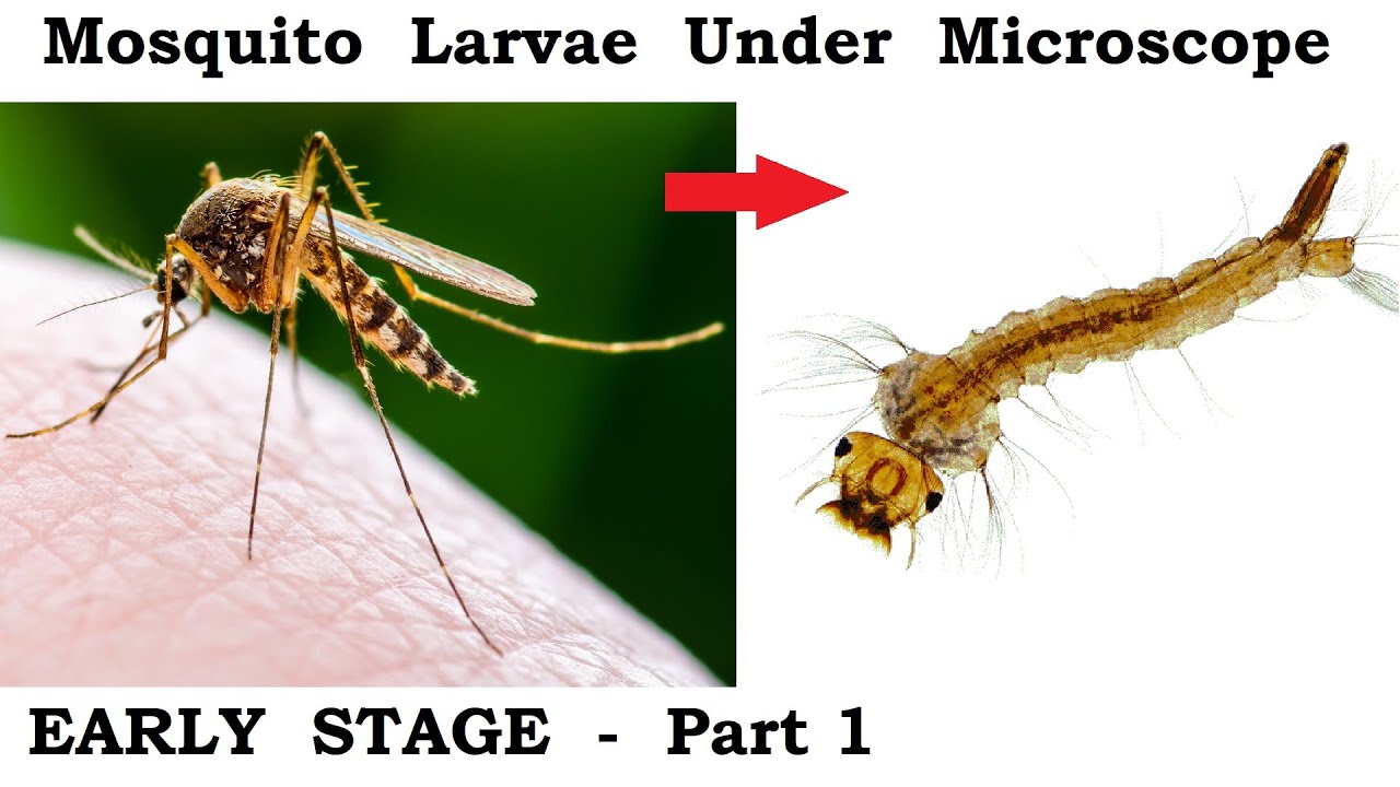 Mosquito Larvae Under a Microscope - Satisfying - YouTube