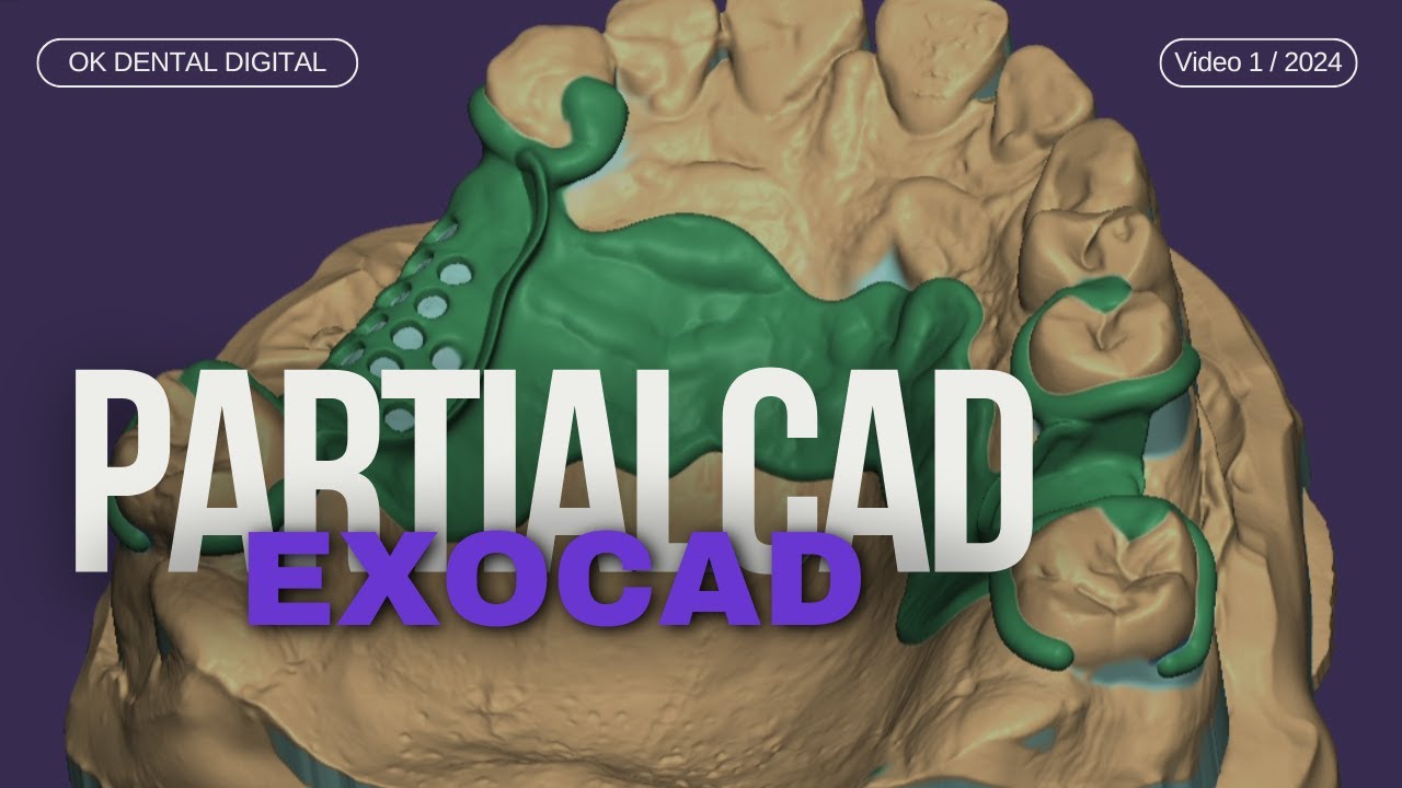 Exoplan Exocad