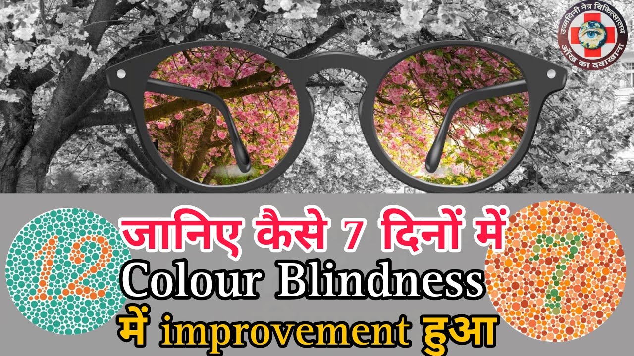 Now i can see colours after 7days tretment by Dr. Rishabh Jain ...