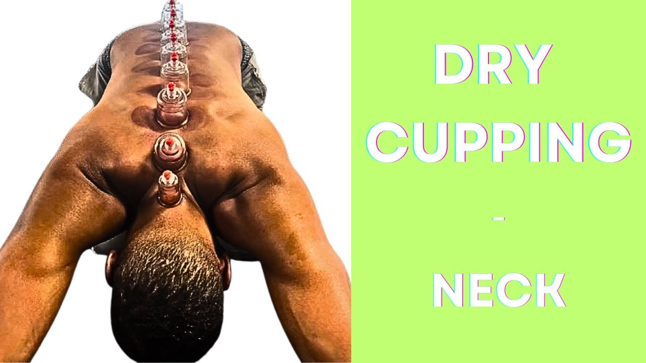Dry Cupping - Muscles of the Neck - YouTube
