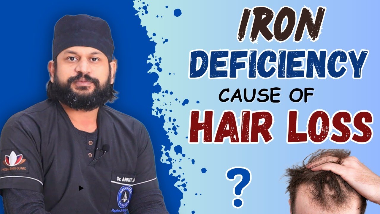 Iron Deficiency is cause of hair loss , Hair fall || #hairfall - YouTube