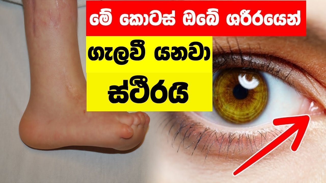 දෙයියනේ මේවා නැතුව කොහොමද ජීවත් වෙන්නේ-Parts of the missing human body ...