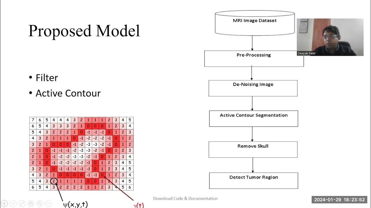 MRI Image Brain Tumor Segmentation | Brain Tumor Identification by Active Contour MATLAB Source ...