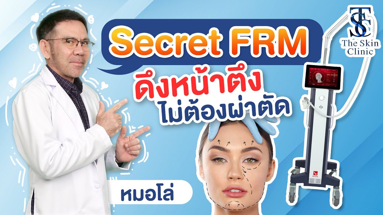 Secret FRM นวัตกรรมใหม่แห่งวงการยกกระชับผิวหน้า บอกลาหน้าหย่อนคล้อย - YouTube