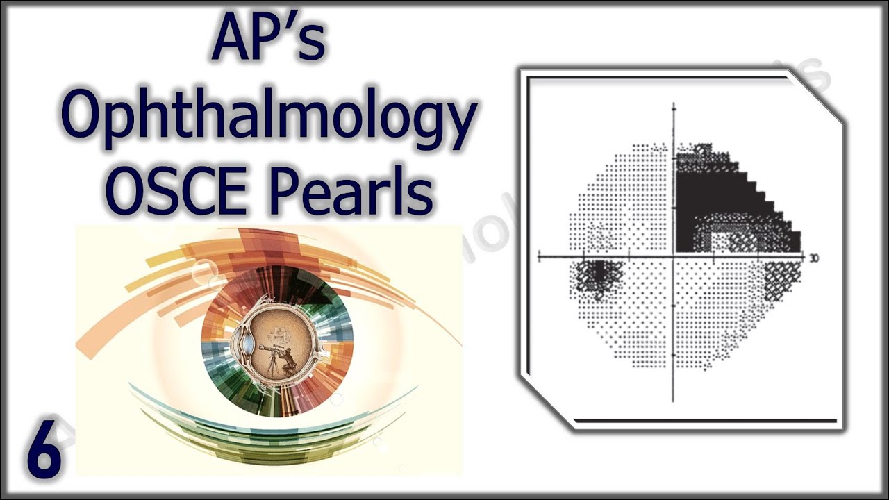 AP's Ophthalmology OSCE Pearls 6 - YouTube