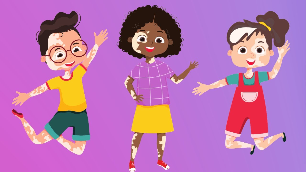 The Beautiful Vitiligo Kids - YouTube