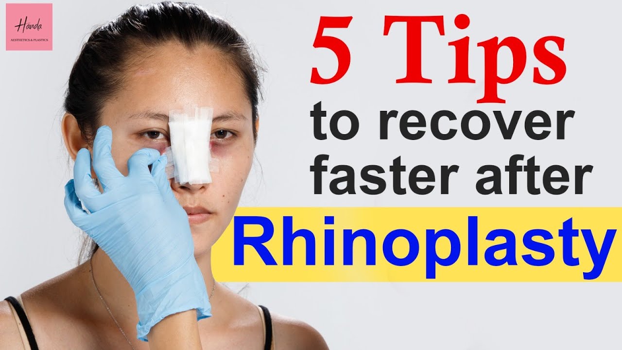 🔴Post-Op Rhinoplasty | Tips to Recover Faster After Rhinoplasty Surgery ...