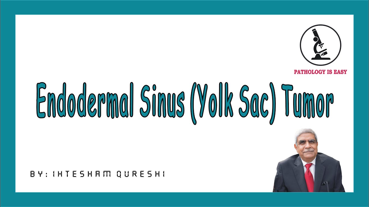 Endodermal Sinus (Yolk Sac)Tumor | Female Genital Tract - YouTube