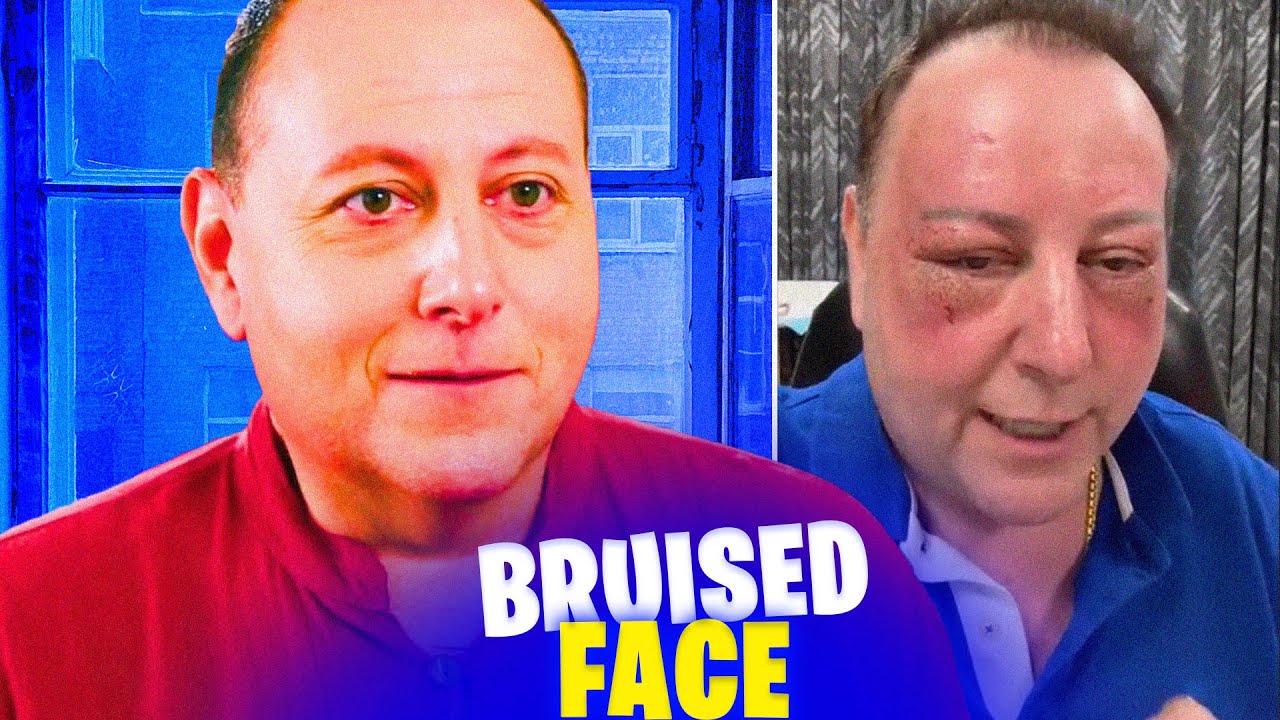 90 Day Fiancé’s David Toborowsky Reveals Shocking Bloody & Bruised Face ...