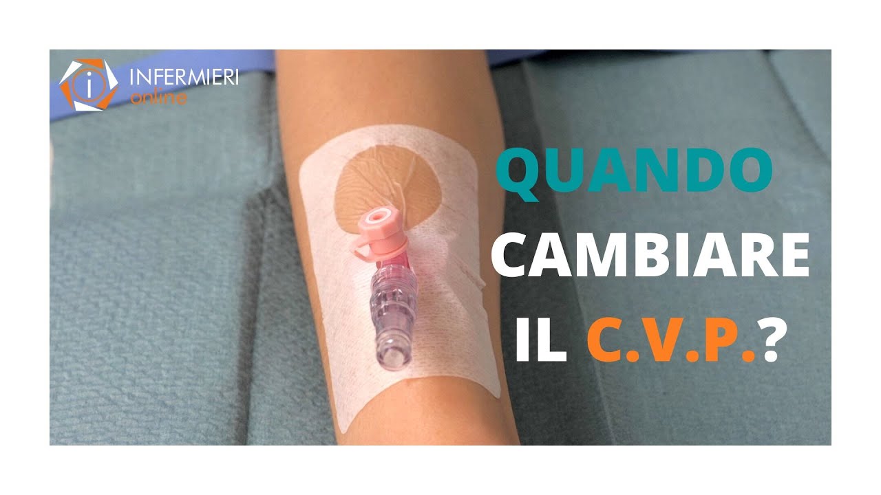 QUANDO DOBBIAMO CAMBIARE UN C.V.P.? | LA SCALA VIP | INFERMIERI Online ...