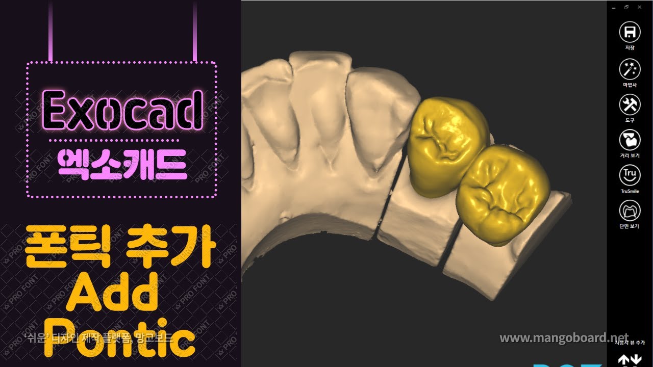 치과기공사 엑소캐드 익스텐션 파닉 추가하는 방법 / Dental technician exocad How to add a ...