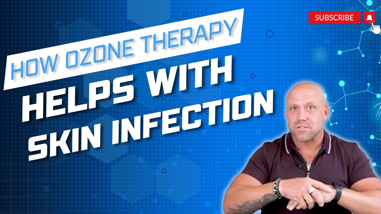 Ozone therapy for skin infections | Uses, benefits, side effects, and ...