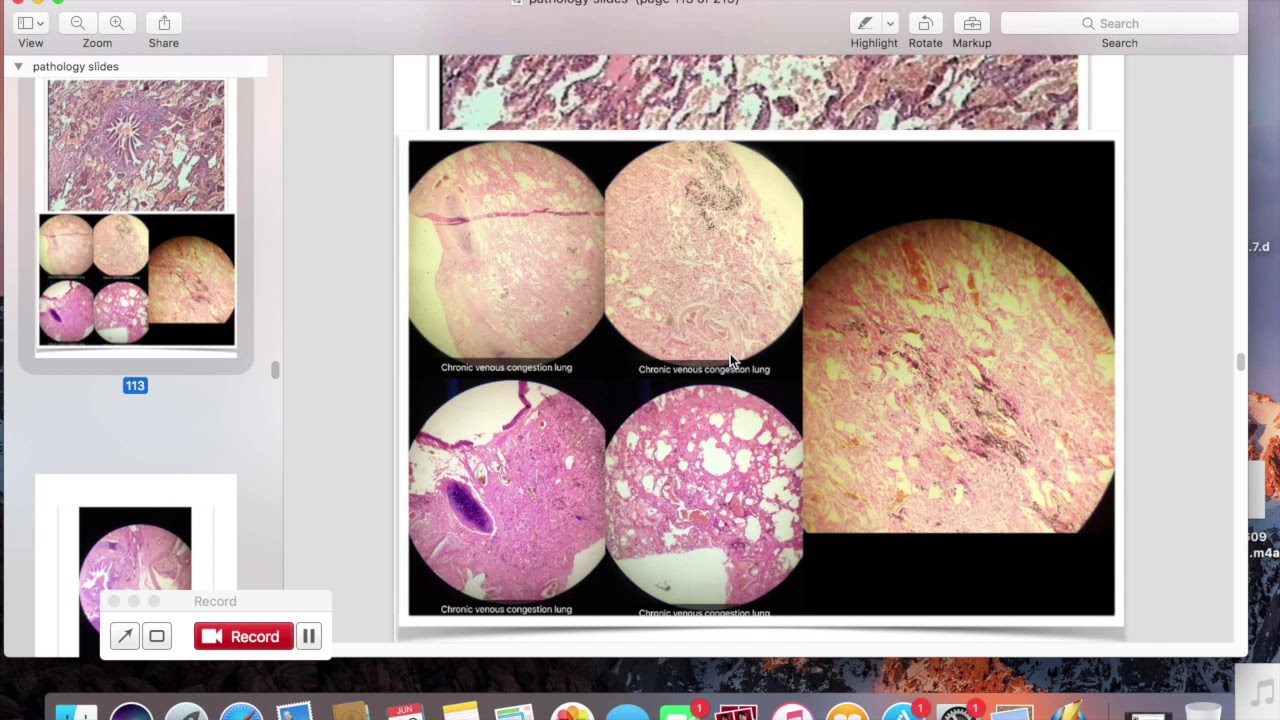 Pathology slides - MMH - part 2 - YouTube