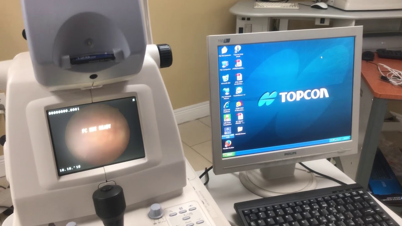 Topcon NW-200 Fundus Camera basics - YouTube