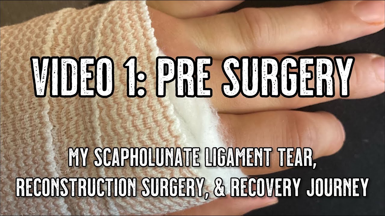 Scapholunate Ligament Tear and Reconstruction - Video 1: Pre-Surgery - YouTube