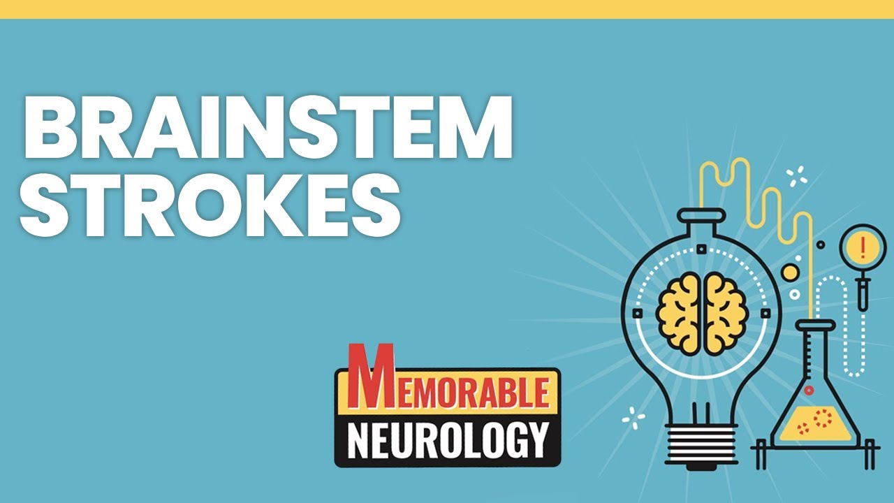 Brainstem Stroke Mnemonics Memorable Neurology Lecture 15 YouTube