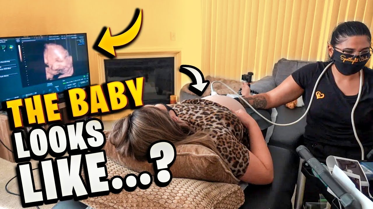 4D ULTRASOUND - 34 WEEKS PREGNANT - YouTube