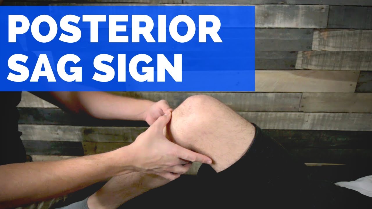 Posterior Sag Sign | PCL Tear Test - YouTube