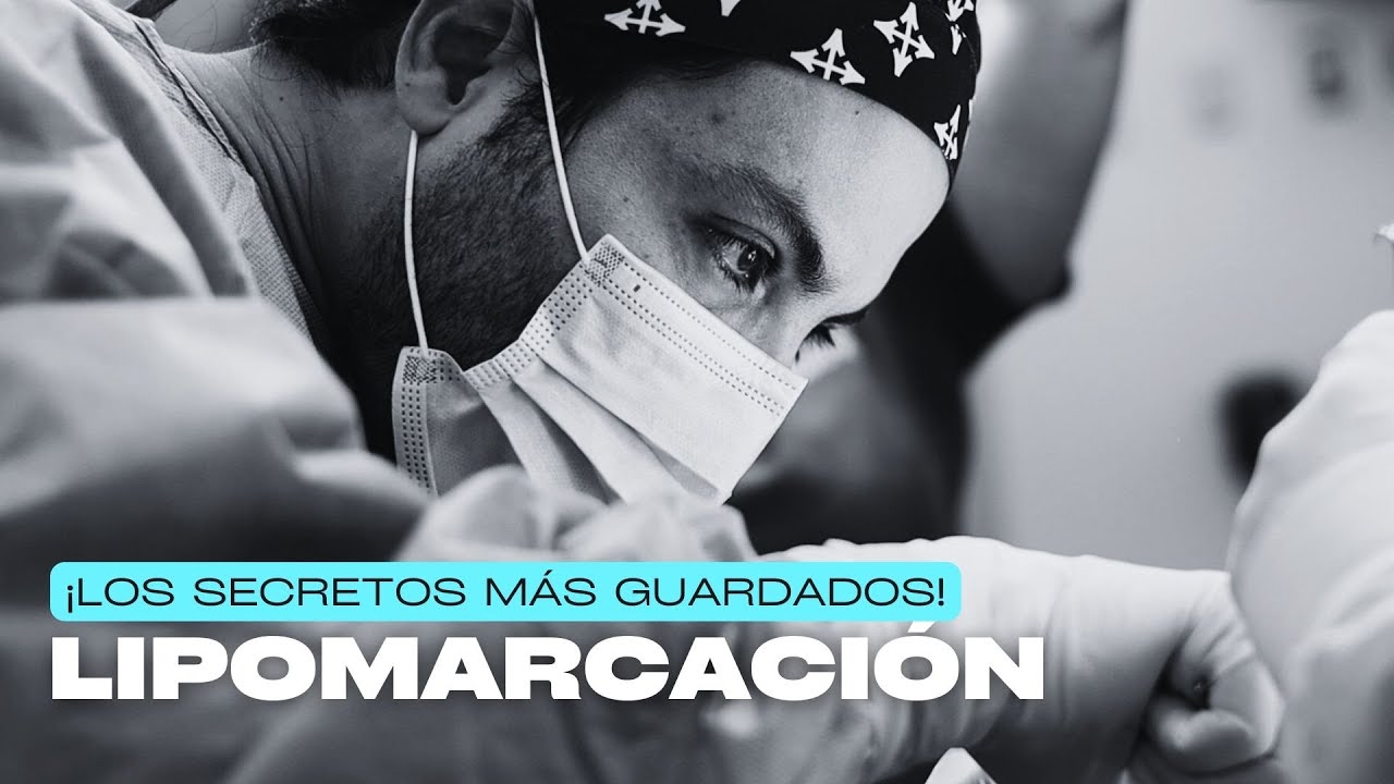 ¡Descubre los secretos mejor guardados sobre la Lipomarcación Abdominal ...